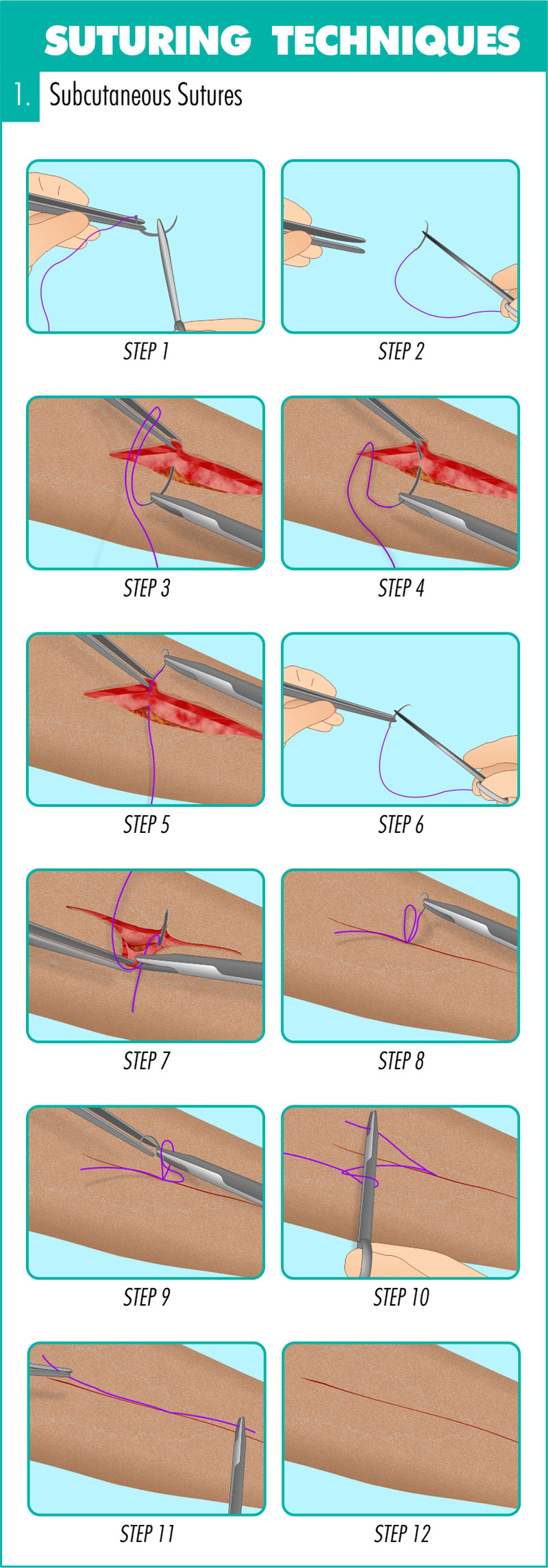 Complete Guide To Mastering Suturing Techniques